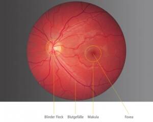 Macular Diseases – DR. Ahmed Galal